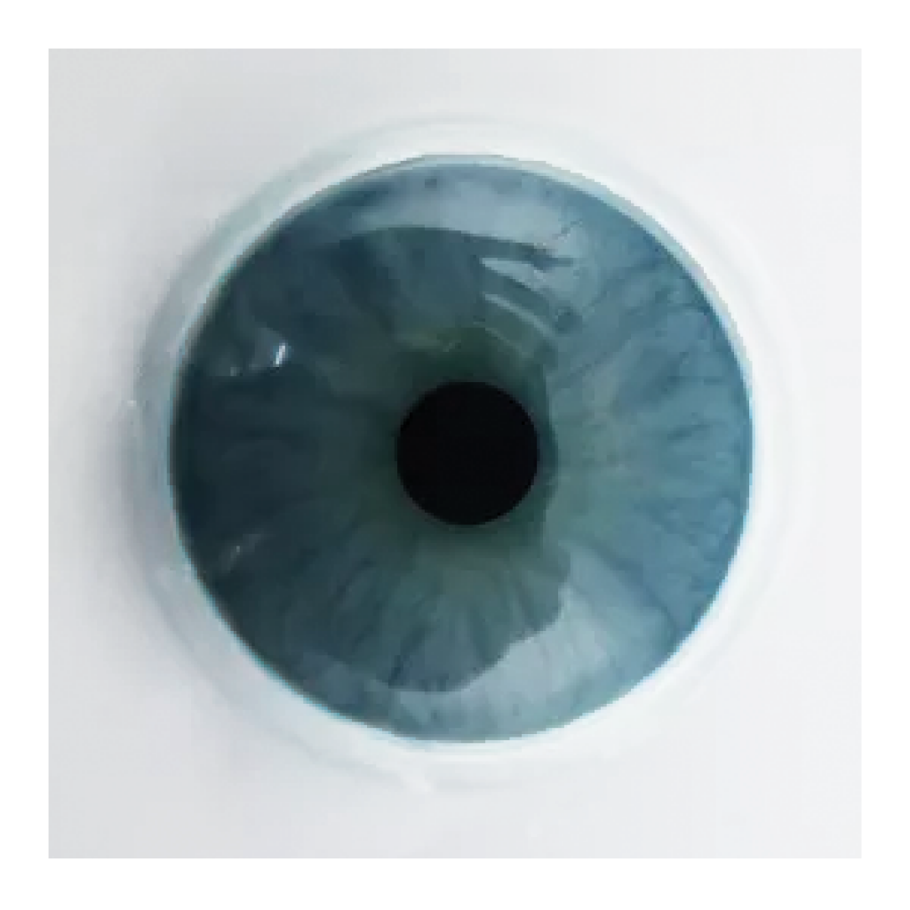 Nissel Custom – ProCornea