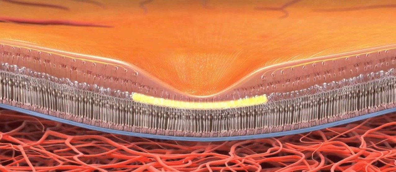 Kurs og webinarer – ProCornea